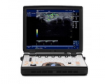GE Logiq E NextGen Ultrasound Price, Specs and Machine Comparisons ...