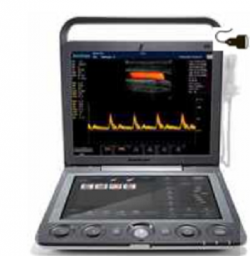 SonoScape S8 Exp Ultrasound Price, Specs and Machine Comparisons ...