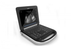 Sonosite Edge II Ultrasound Price, Specs and Machine Comparisons ...
