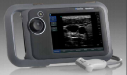 Sonosite NanoMaxx Ultrasound Price, Specs and Machine Comparisons ...